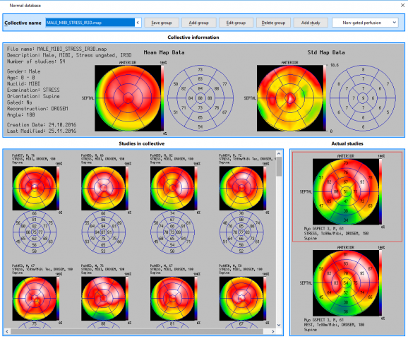 Myocard SPECT – MiE