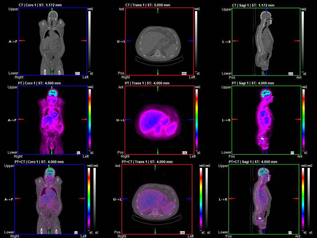 ECAM Scintron – MiE