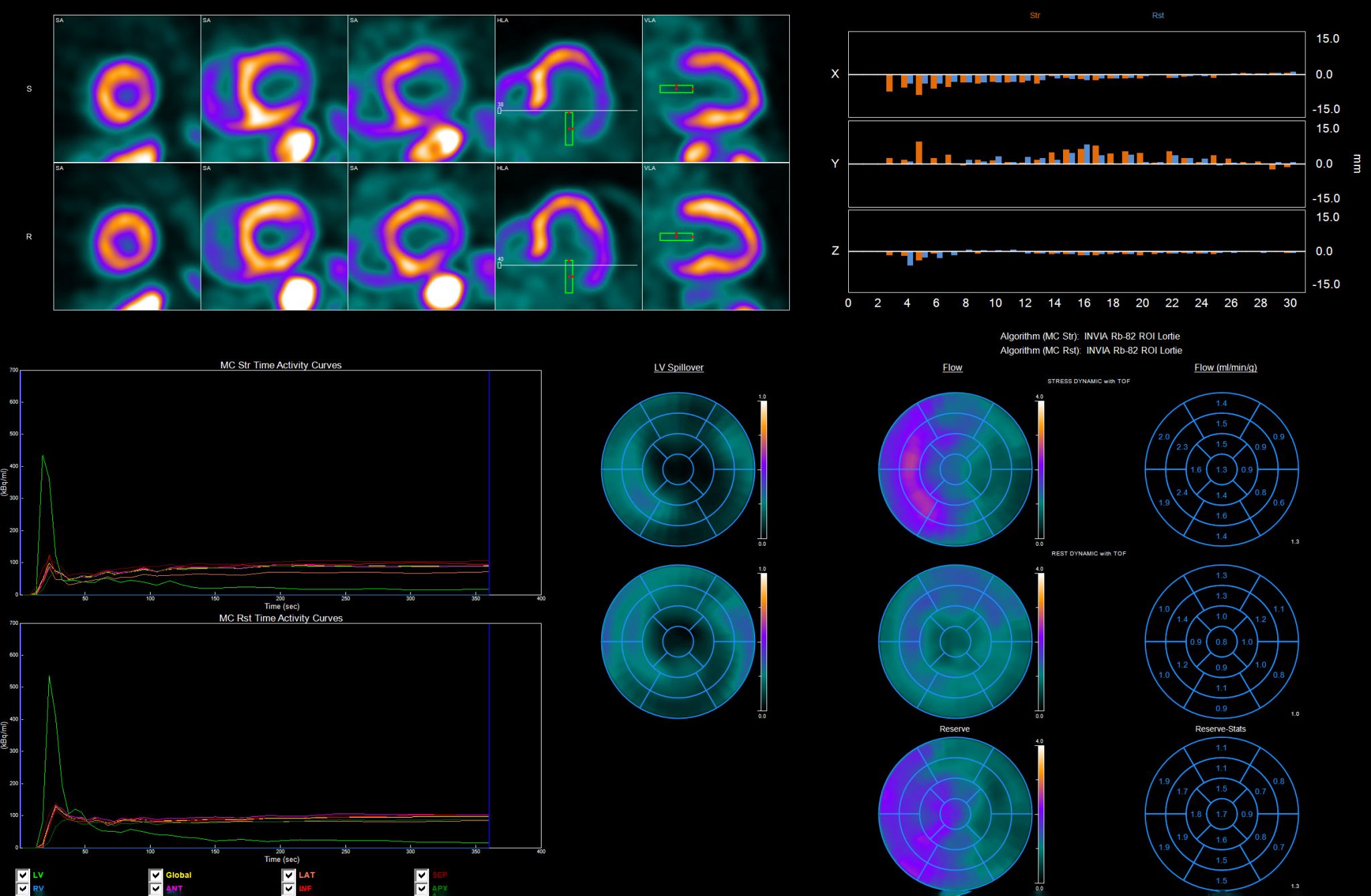 SCINTRON 7 PET/CT – MiE